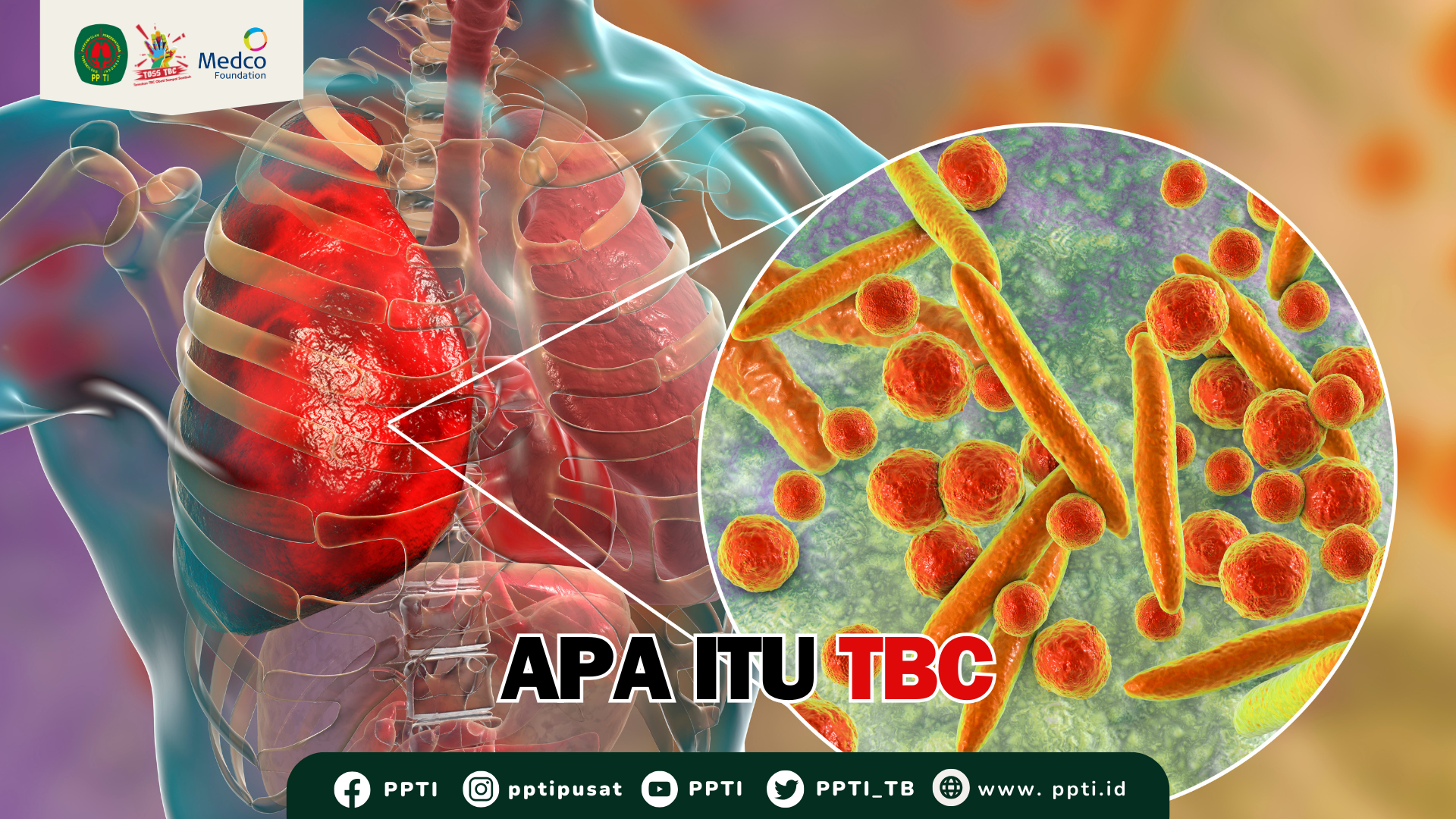 SEPUTAR TBC – PPTI